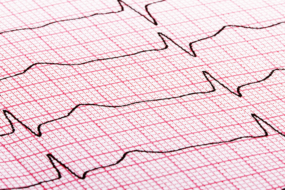 Medical Chart Paper l Manufacturer & Exporter