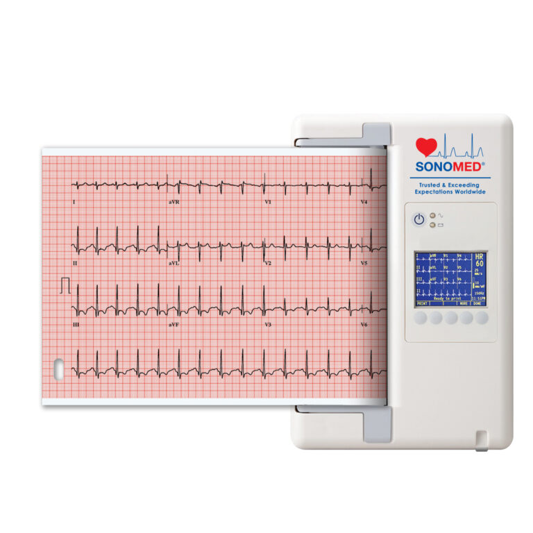 Medical Chart Paper, precise gridline spacing, good ink adhesiveness
